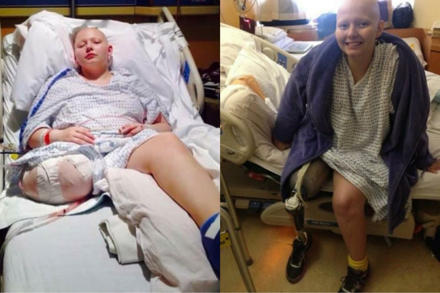 I Yeeted Bone Cancer - Zanaposh